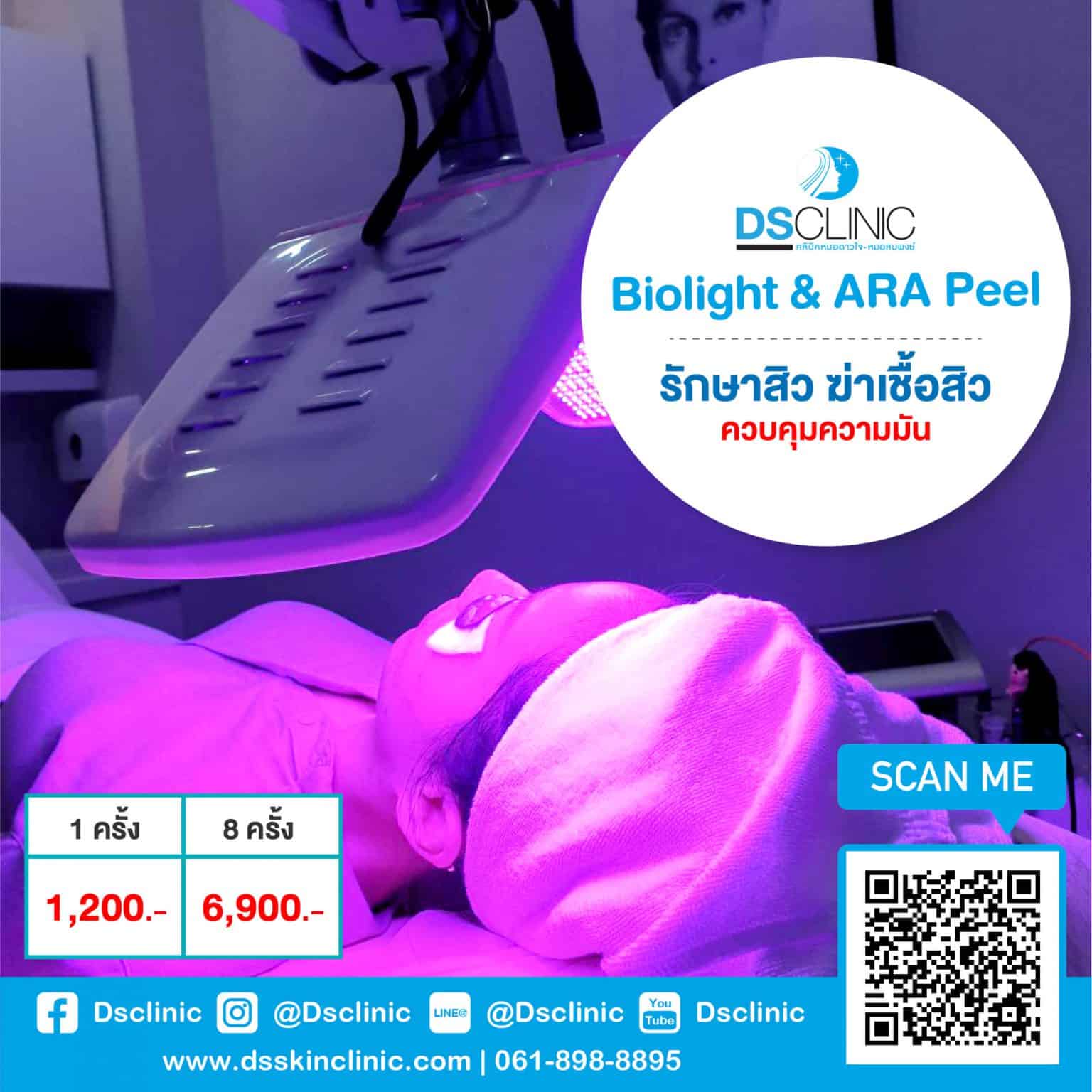 รักษาสิว BIOLIGHT -Ds Cilnic ศุนย์เลเซอร์ ความงาม โดยแพทย์เฉพาะทาง
