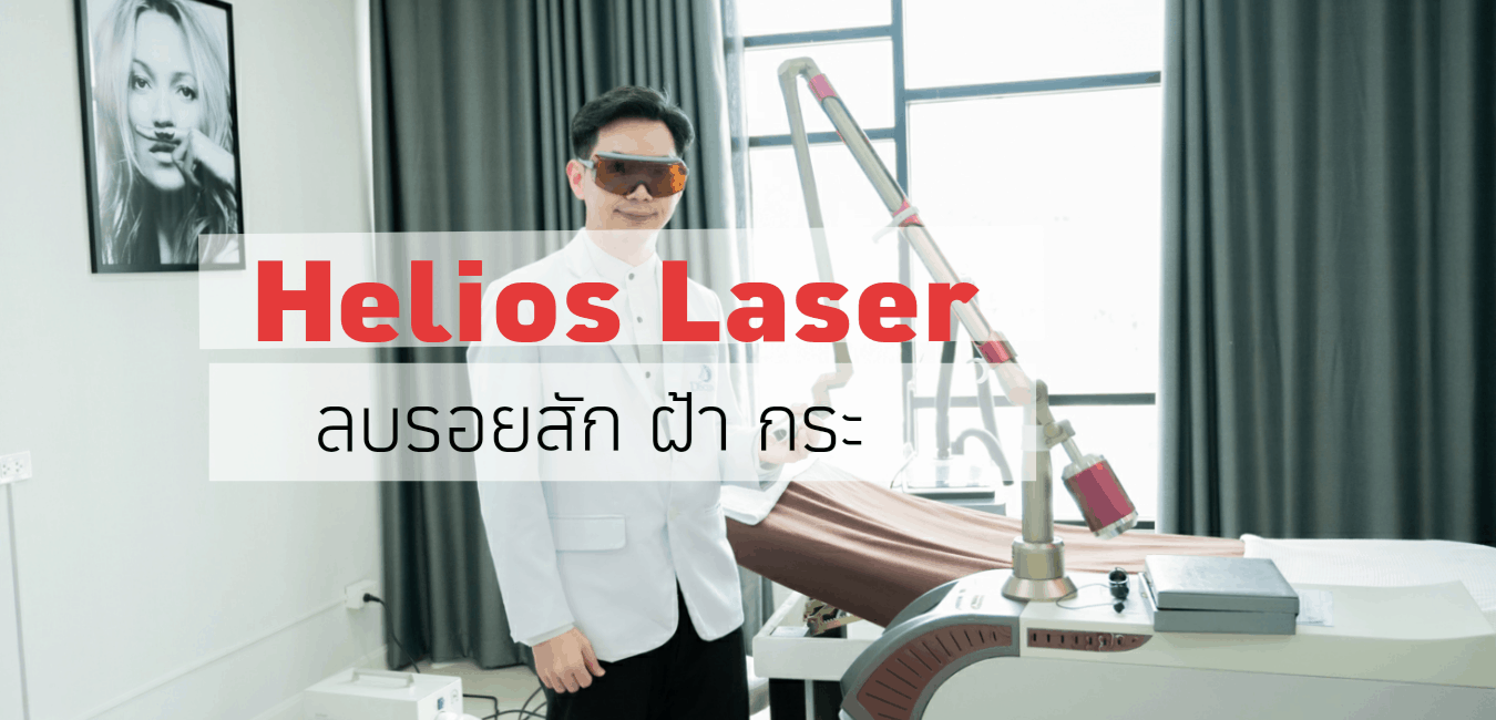 ลบรอยสัก Helios laser II เลเซอร์ลบรอยสัก กระ จุดด่างดำ Ds Cilnic