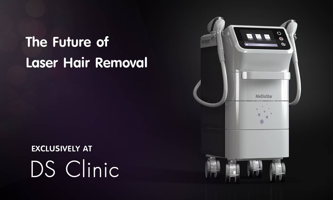 กำจัดขน New MEDIOSTAR นวัตกรรมใหม่ของการกำจัดขน - DS CLICIN